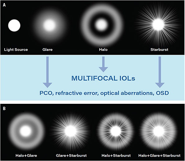 Why Am I Seeing Halos After Cataract Surgery Infoupdate Why Am I Seeing Halos After Cataract Surgery Infoupdate