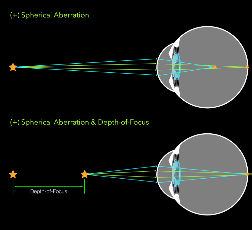 Spherical Aberration and the Light Adjustable Lens | Presbyopia Physician
